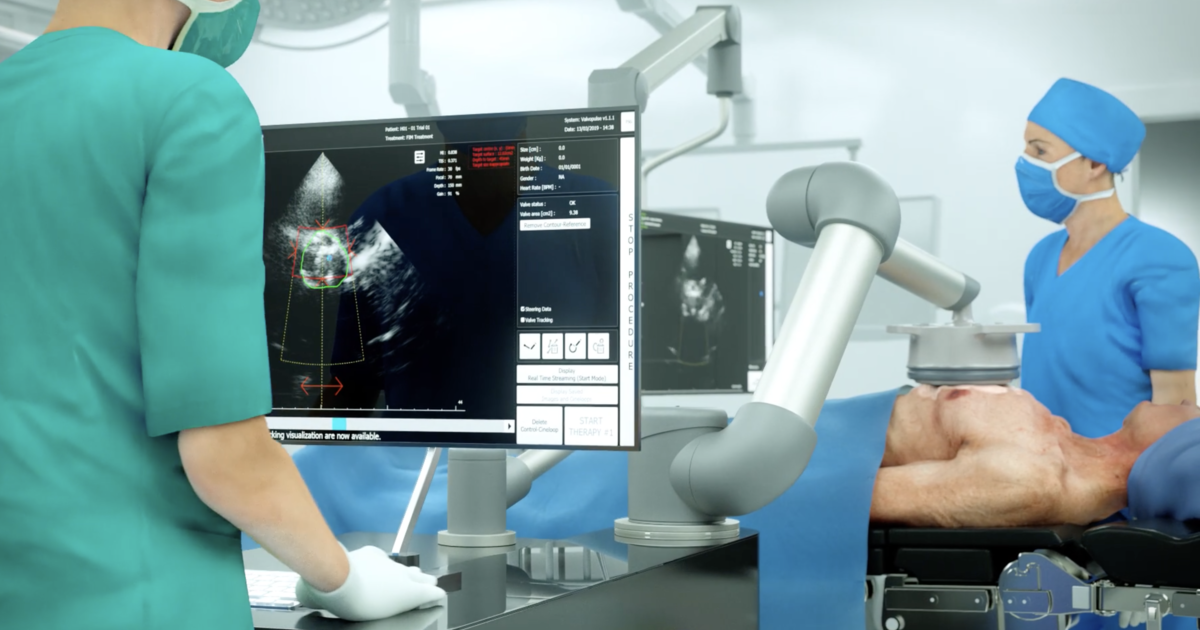 Cardiawave’s non-invasive ultrasound therapy impresses cardiologists ...