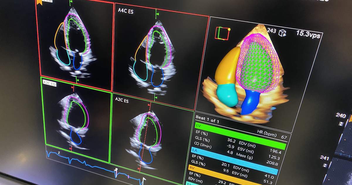 Cardiology now has more than 100 FDA cleared AI algorithms