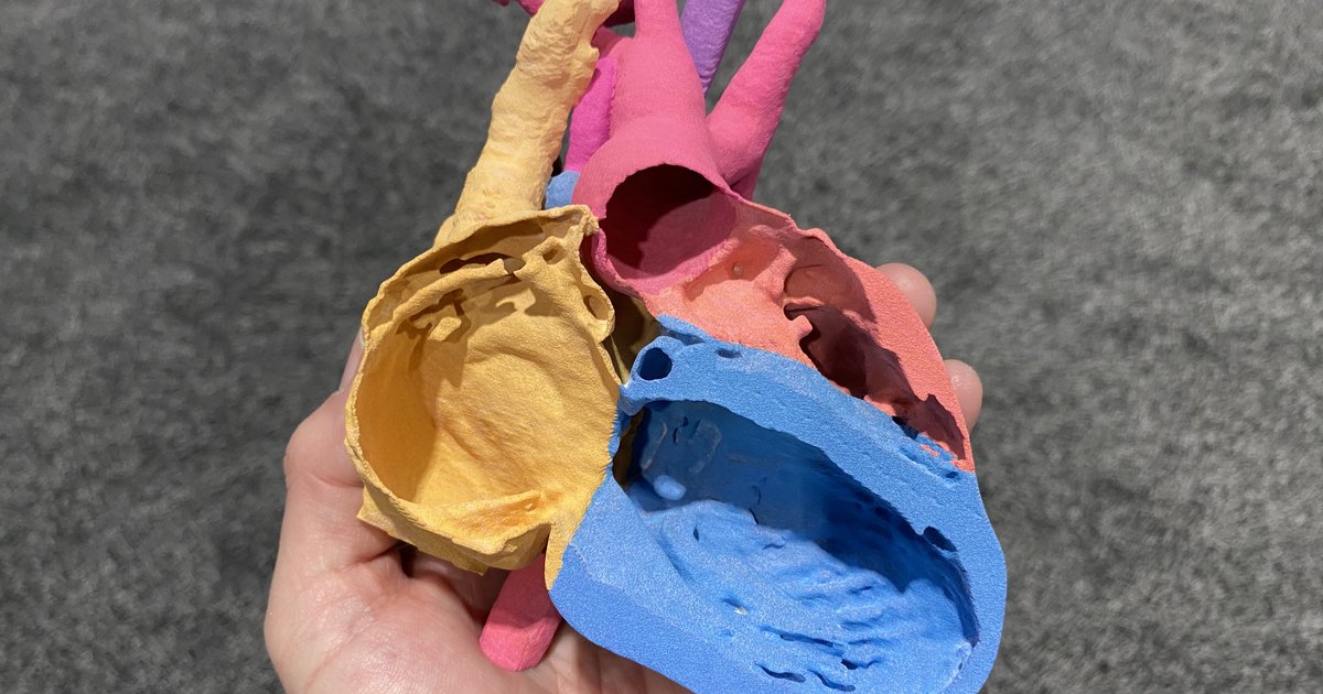 SCAI outlines broken Medicaid reimbursement model for congenital heart ...