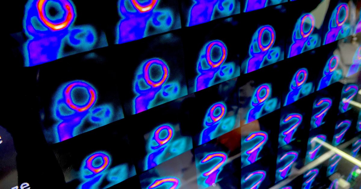 How the proposed Medicare Physician Fee Schedule could impact nuclear ...