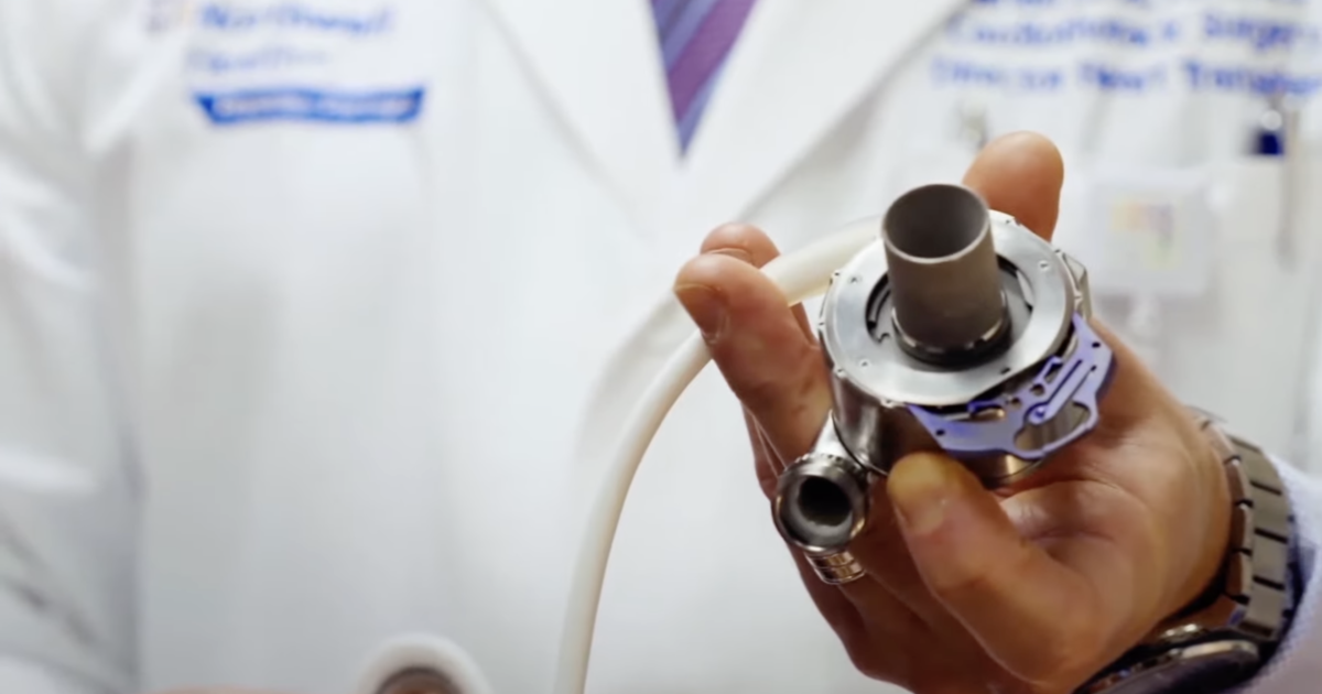 FDA announces new recall of Abbott’s HeartMate LVADs after 14 deaths