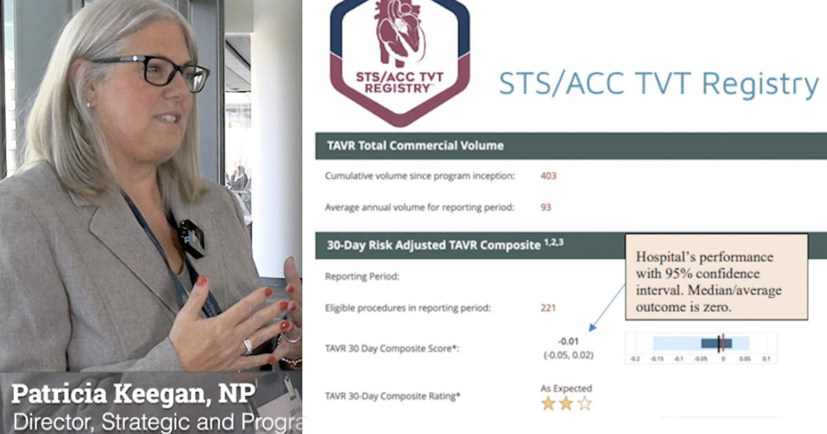 Data registries have been a huge success for U.S. structural heart programs