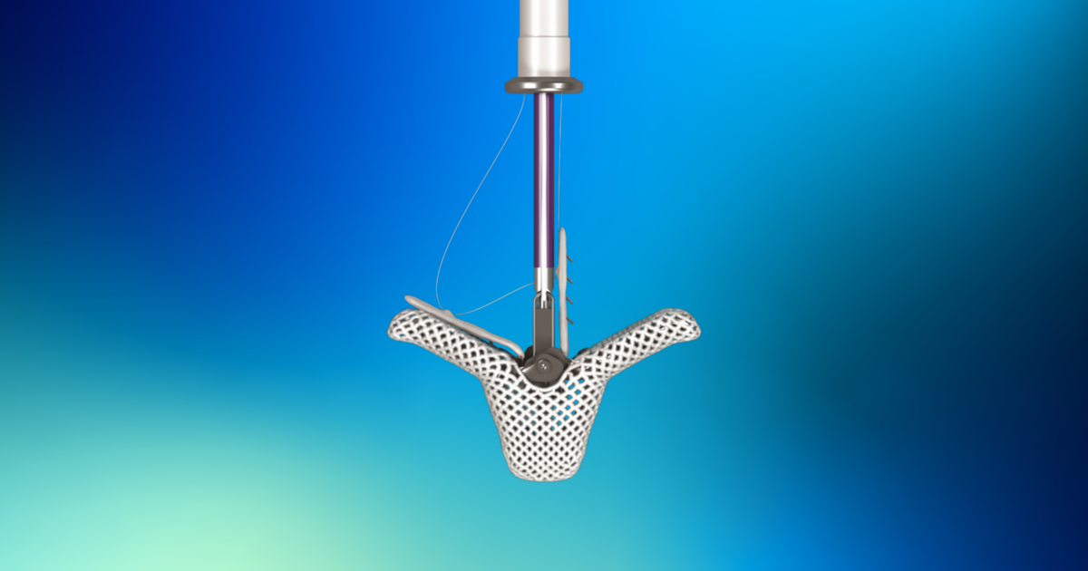 FDA approves Abbott’s TriClip TEER device for tricuspid regurgitation