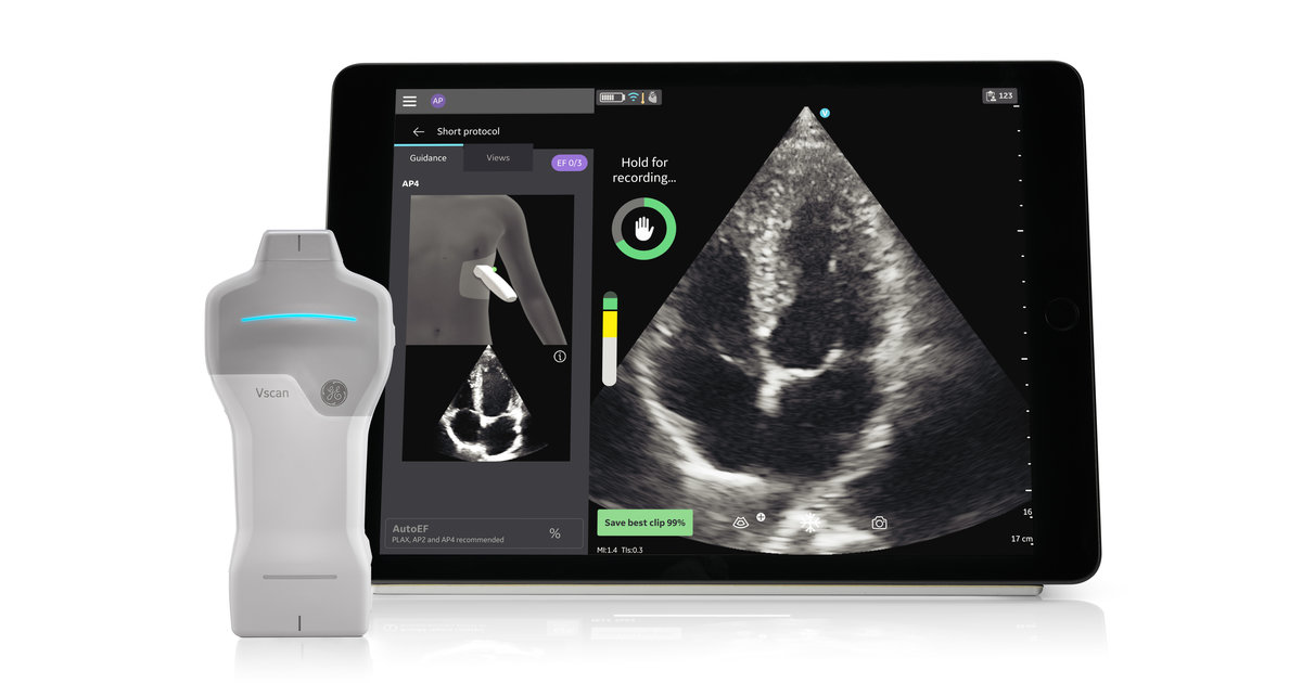 GE Healthcare launching new AI software for handheld ultrasound system