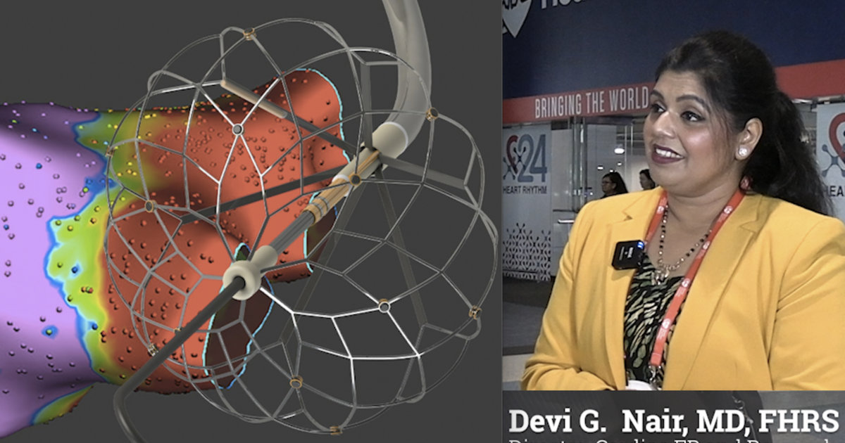 All-in-one PFA system linked to positive safety profile, faster procedures