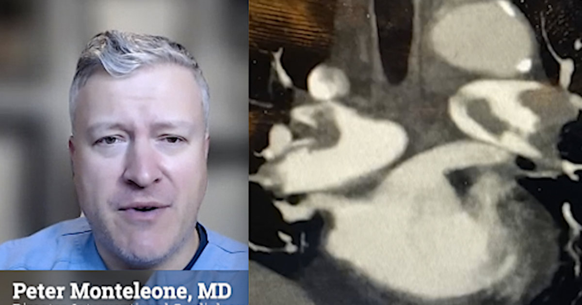 Interventional cardiology sees growing role in pulmonary embolism ...