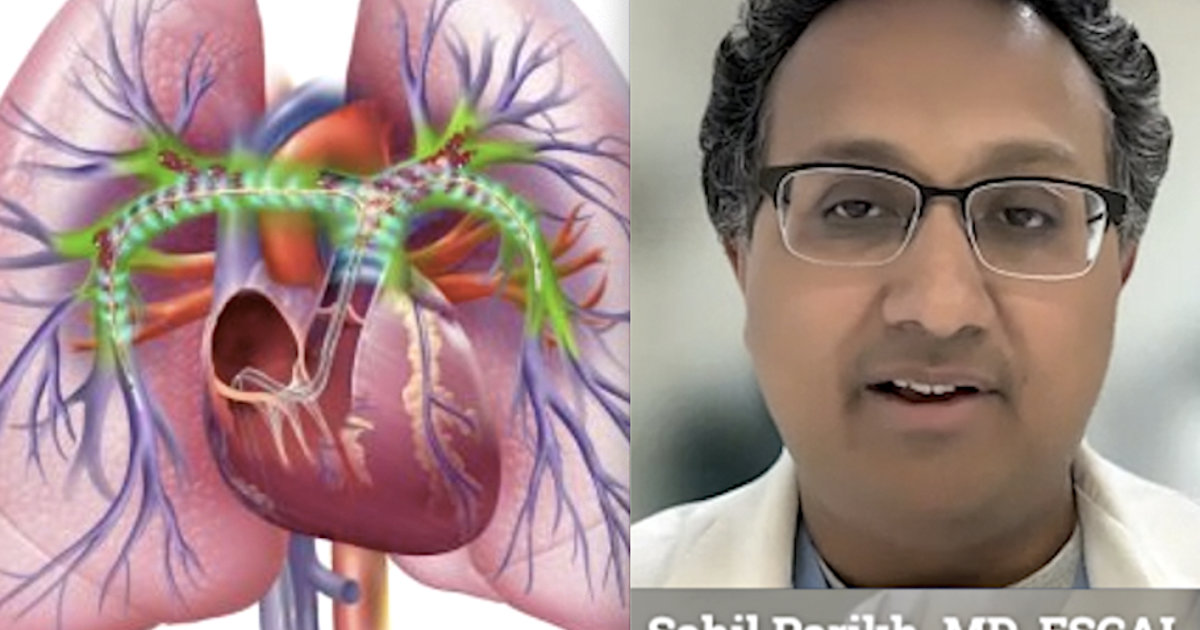 REAL-PE highlights disparities in pulmonary embolism care