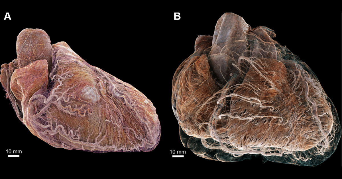 New imaging technique captures human heart with 'unprecedented detail'