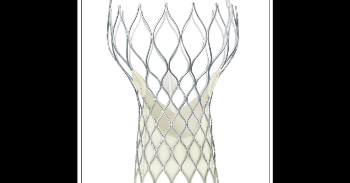 First-generation Medtronic TAVR valves linked to strong outcomes after ...