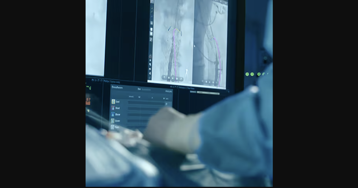 FDA approves longer LumiGuide 3D navigation wire from Philips