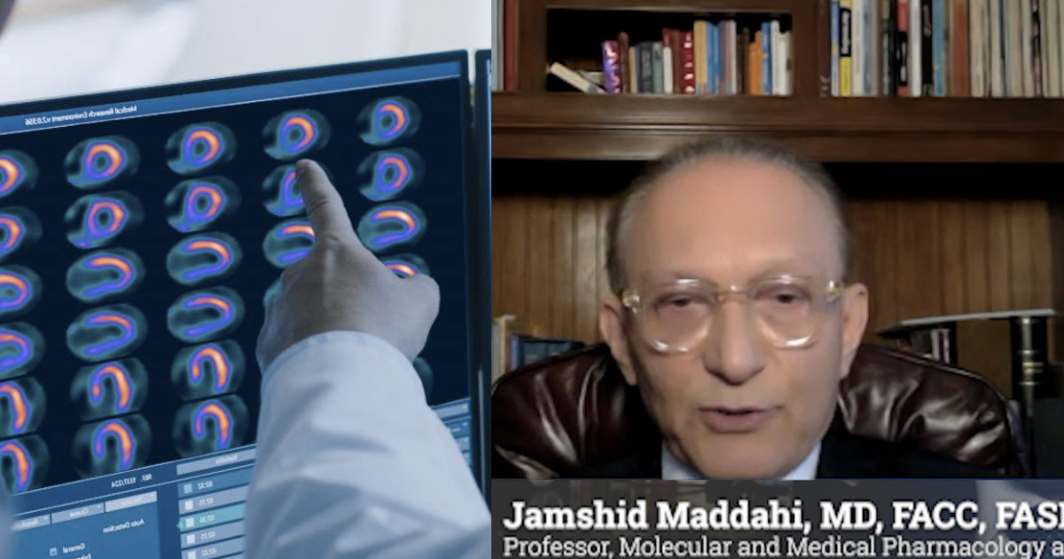 A closer look at how FDA's flurpiridaz approval will impact nuclear ...