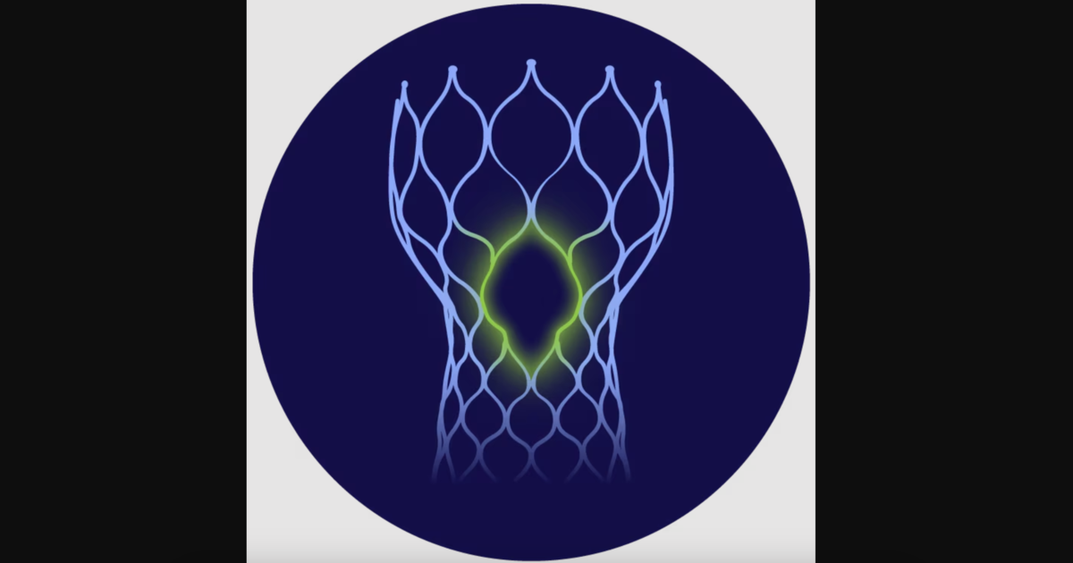 Medtronic’s next-generation TAVR device receives CE mark approval