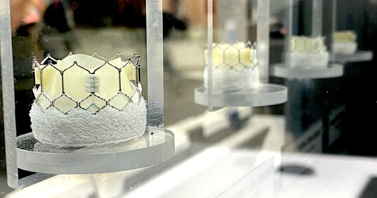 Early TAVR for asymptomatic severe AS cuts costs, improves outcomes