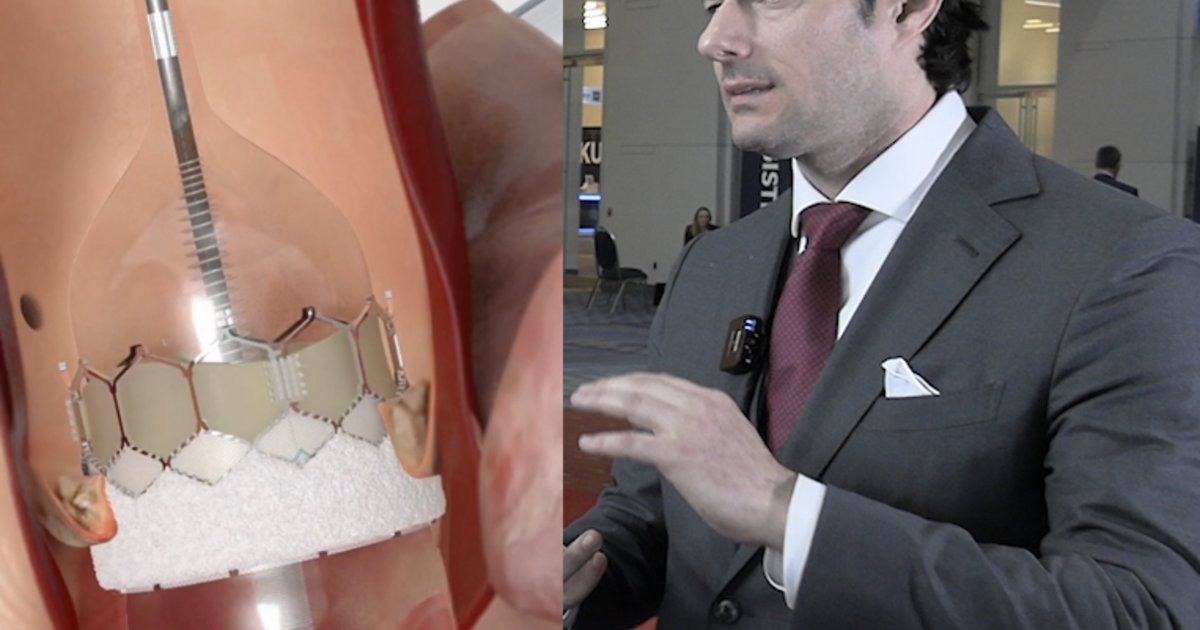 New data put a spotlight on troubling TAVR trends