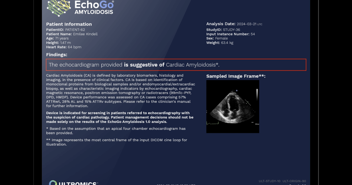 AI-enhanced echocardiography improves early detection of cardiac ...
