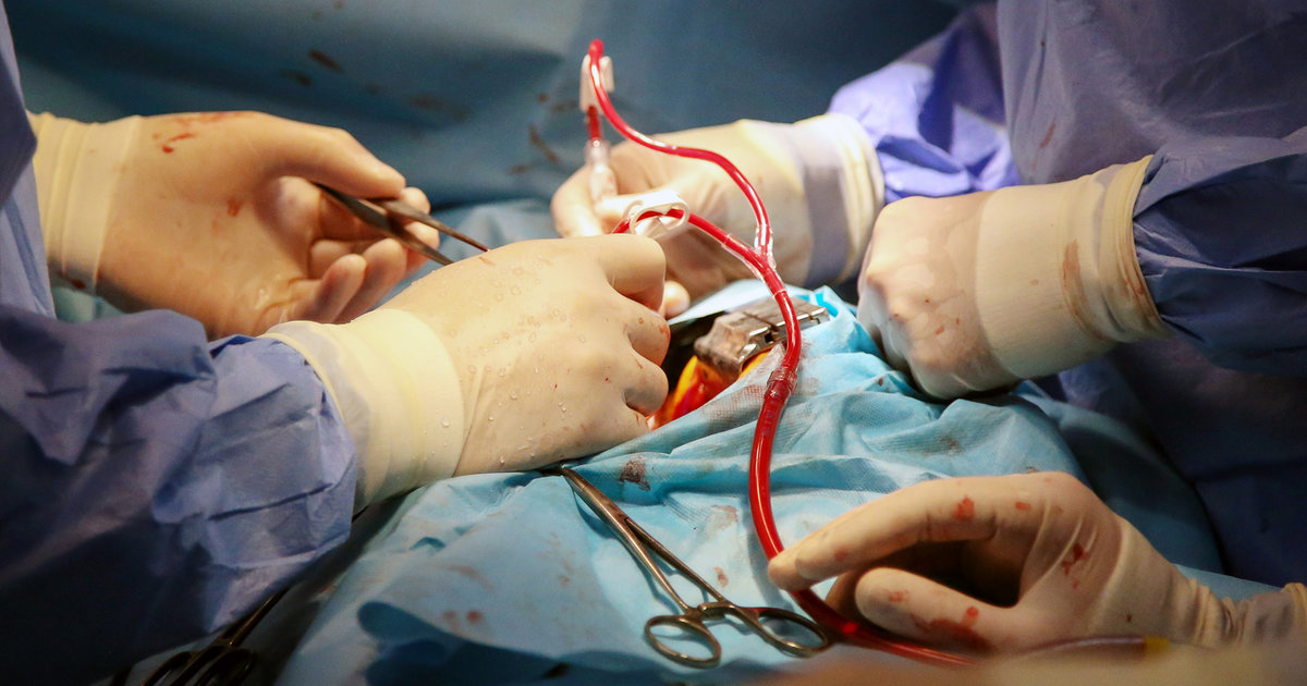 How pairing SAVR with additional heart surgeries affects mortality risk