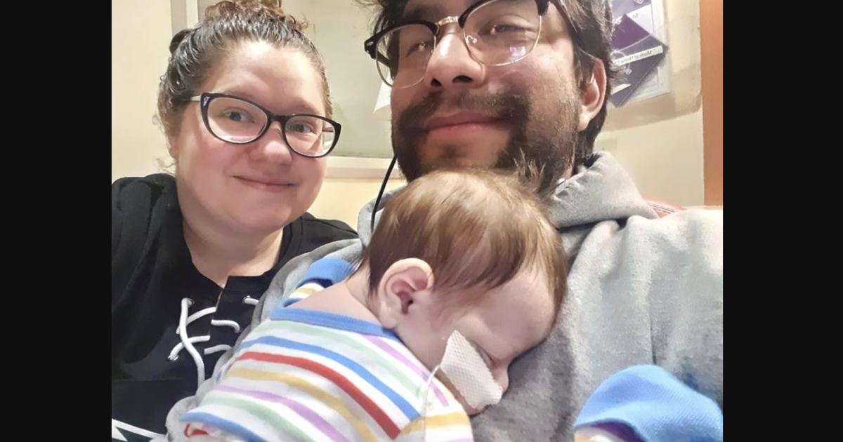 Surgeons first in world to perform open heart surgery on baby mid-delivery