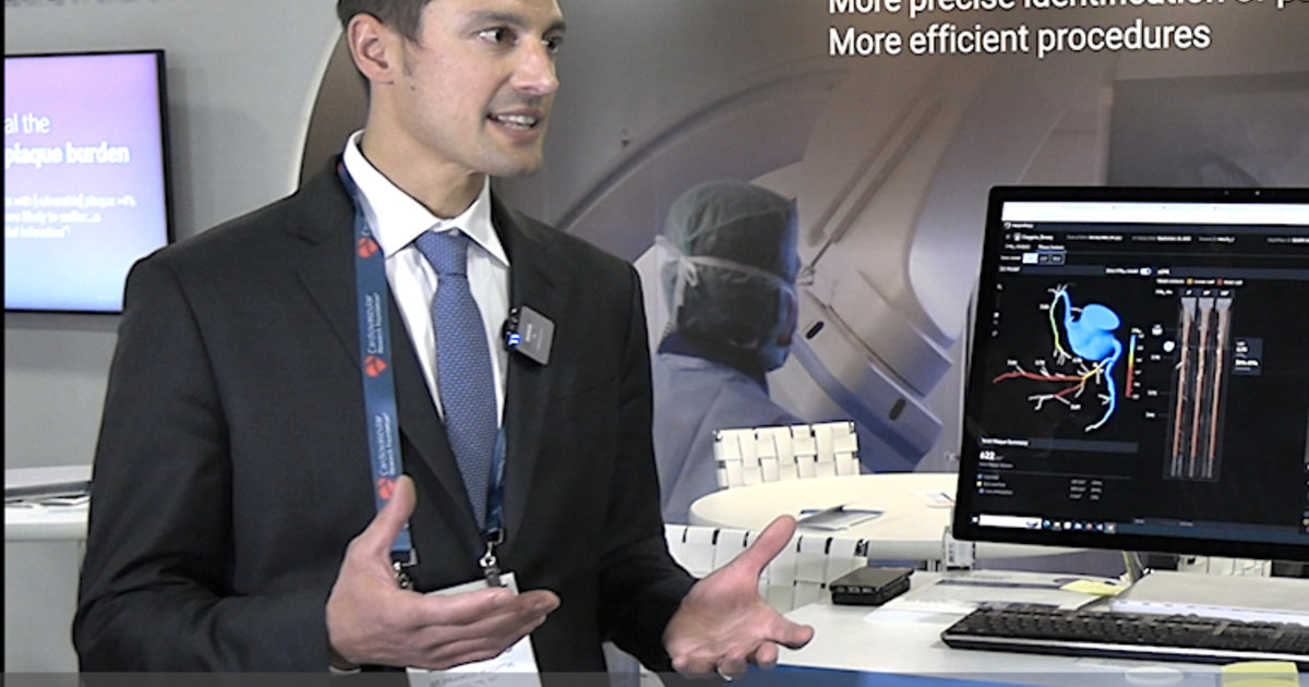 How AI and CCTA help heart teams plan ahead before PCI