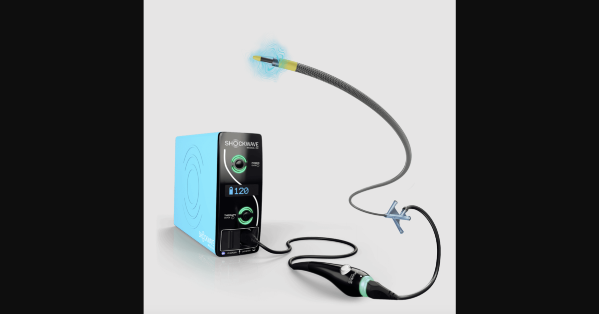 Shockwave Medical launches new IVL catheter for challenging lesions in Europe