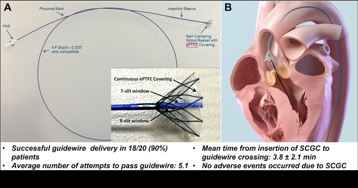 Cardiologists are first in world to use new TAVR catheter from Boston Scientific