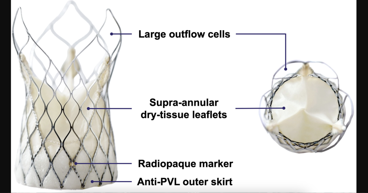 Cardiologists perform world’s first TAVR procedures with new fully ...