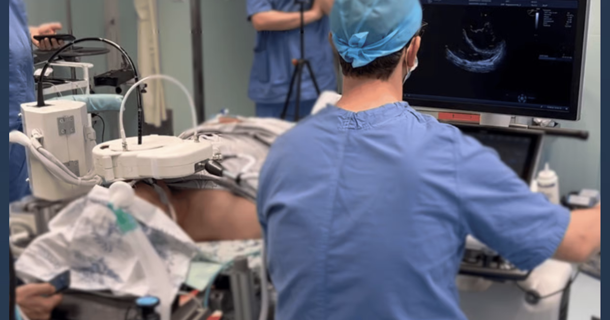 Cardiologists make history, use new robotic imaging system for first time
