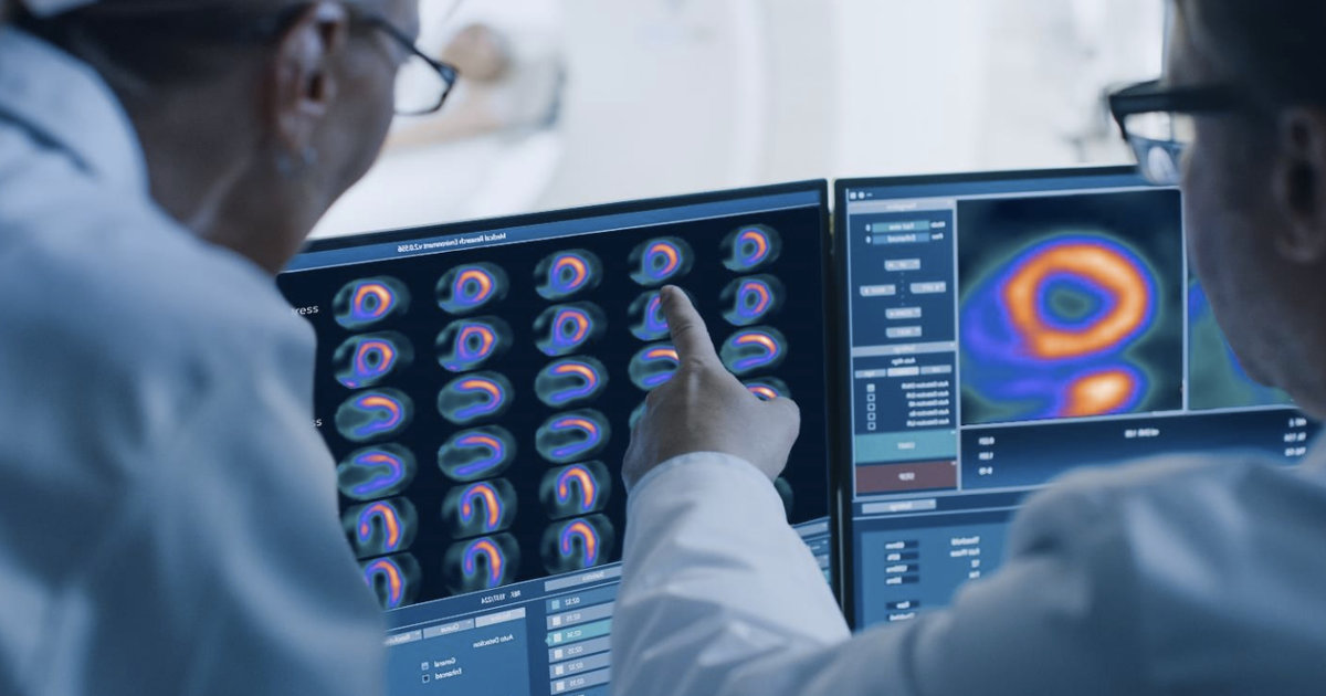 ASNC says PET is now the preferred nuclear imaging test for CAD