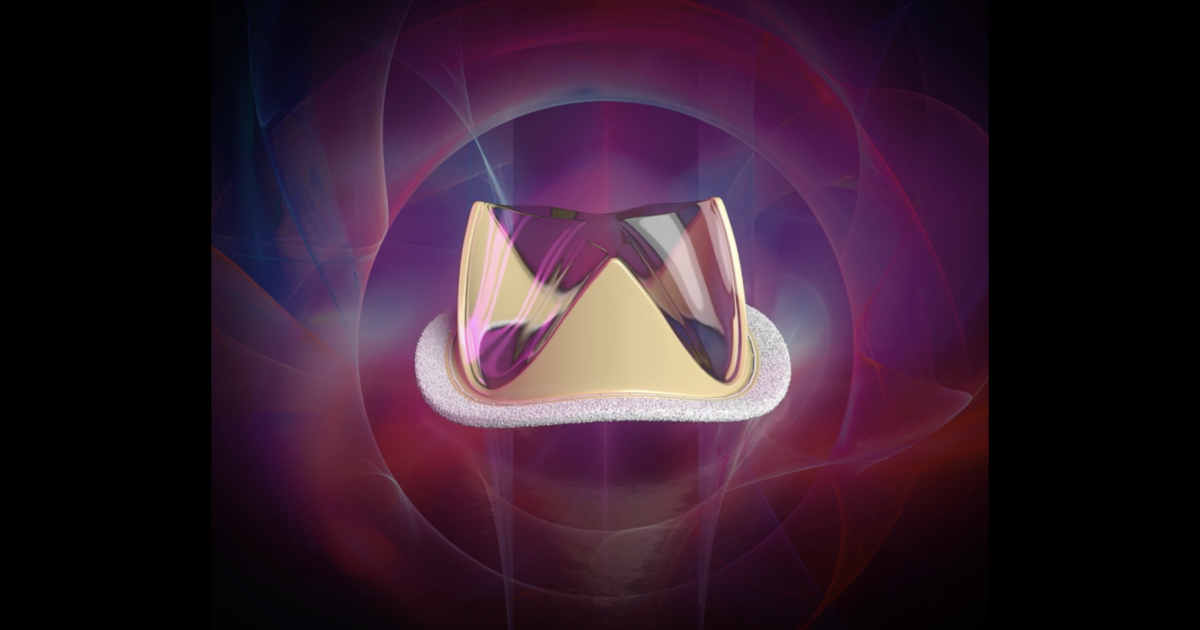 Polymer heart valve, the first of its kind to gain commercial approval ...
