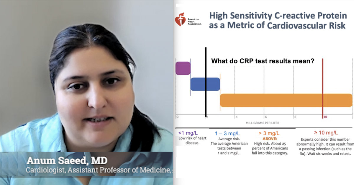 AHA data challenge explores links between inflammation and heart disease