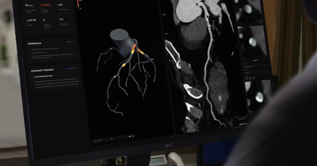 FDA clears CCTA AI coronary plaque assessment from Artrya