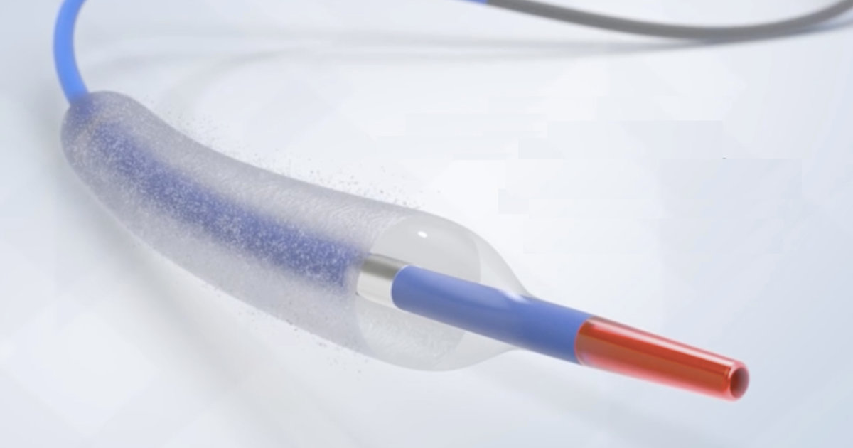 Boston Scientific launches study comparing drug-coated balloons to ...