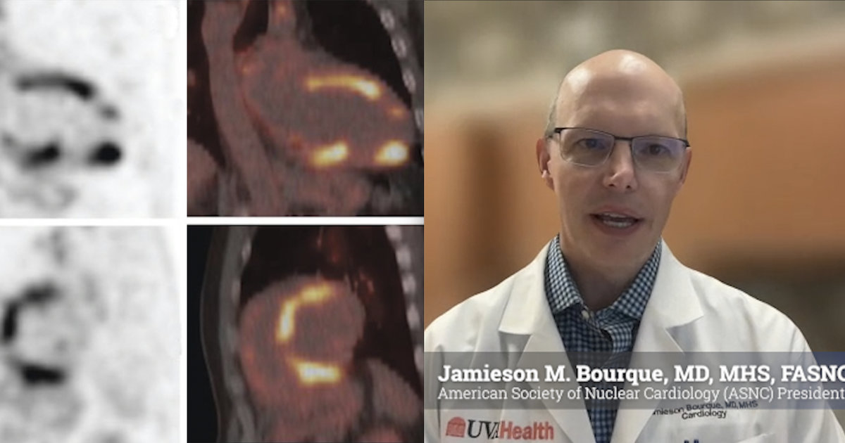 Incoming ASNC president making AI's integration into nuclear cardiology ...