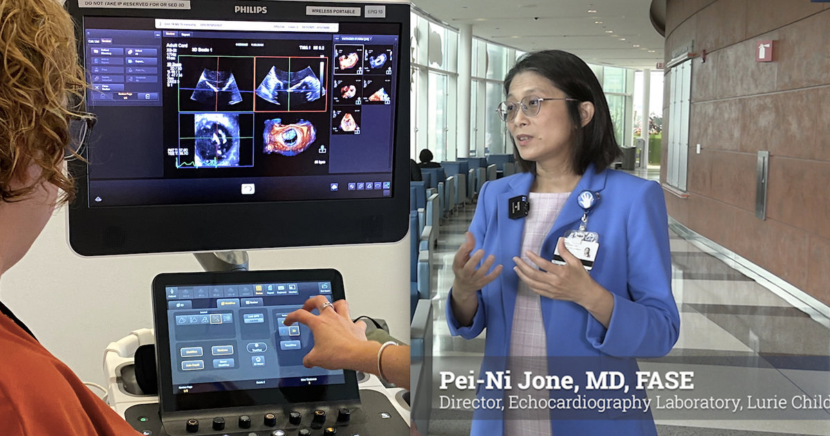 3D echo guidance seeing increasing use in congenital heart surgery