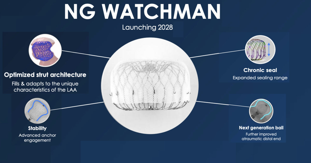 Next-generation Watchman enters trial in 2026 as LAAO volume grows