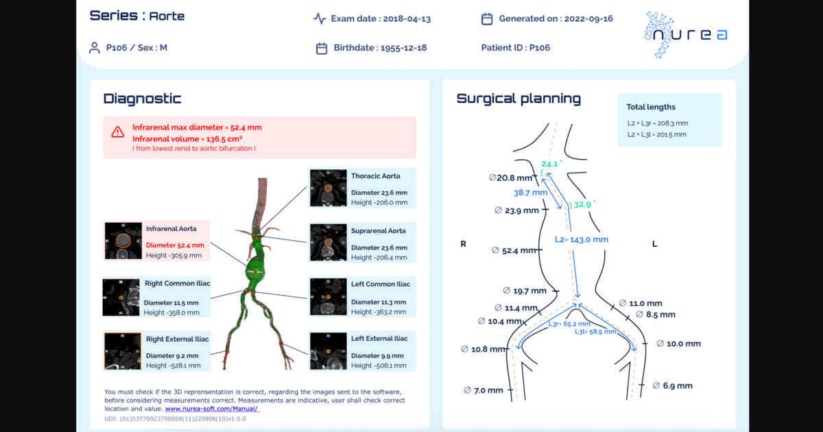 FDA clears AI-powered vascular imaging software