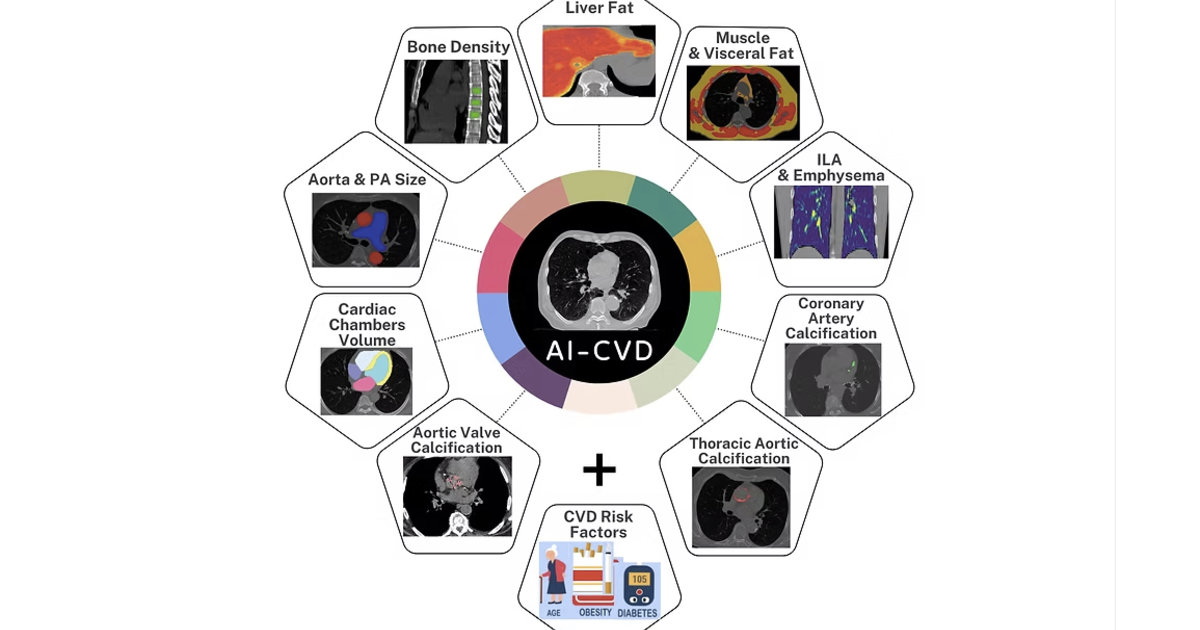 FDA clears opportunistic AI for detecting cardiothoracic issues in CT scans