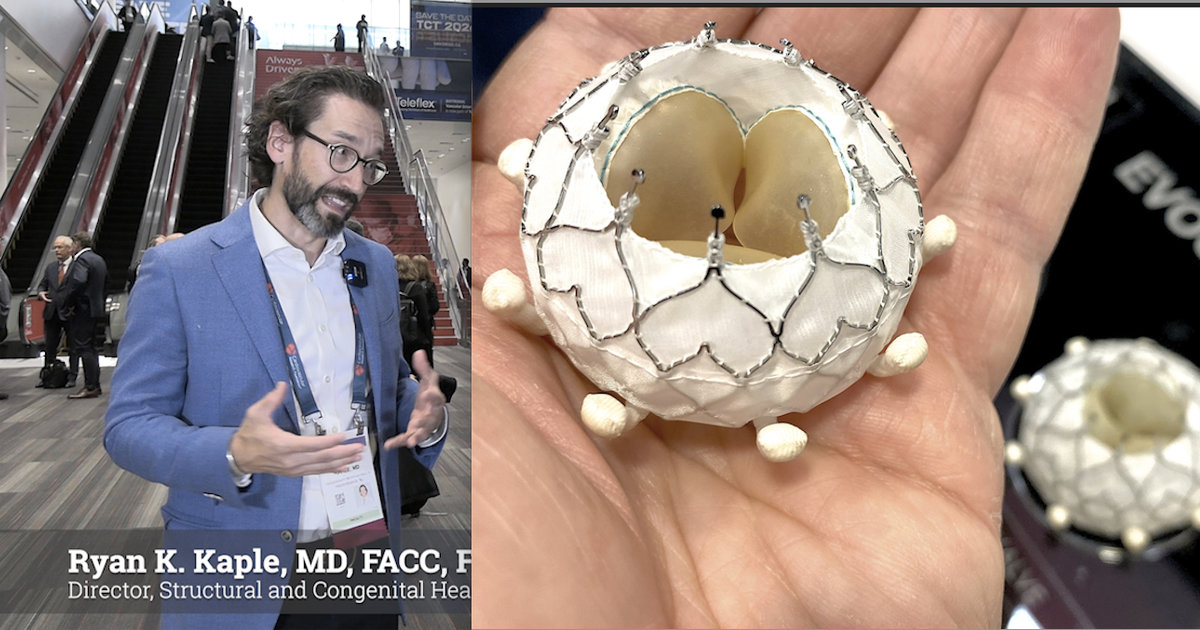 Key trends in transcatheter tricuspid valve repair and replacement