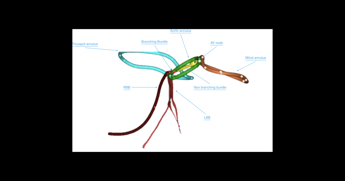 FDA clears AI-powered platform that personalizes care during TAVR ...