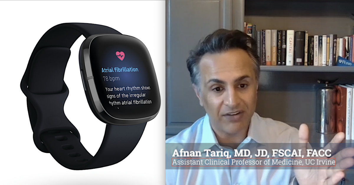 AI turns wearable device data into actionable insights for heart ...