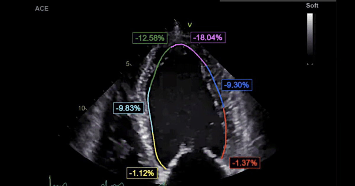 Cardiology now has more than 200 FDA-cleared AI algorithms