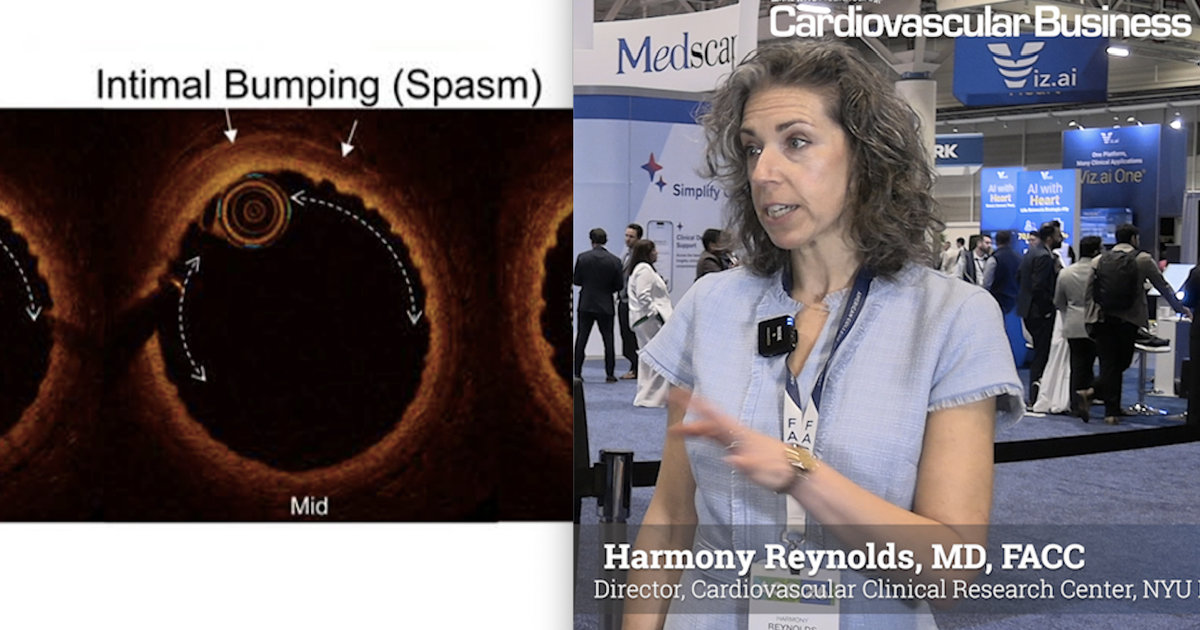 Researchers use multi-modality imaging to learn more about MINOCA