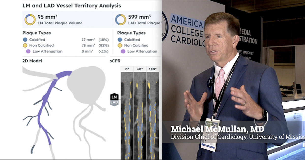 CCTA scan at conference gives cardiologist a wake-up call