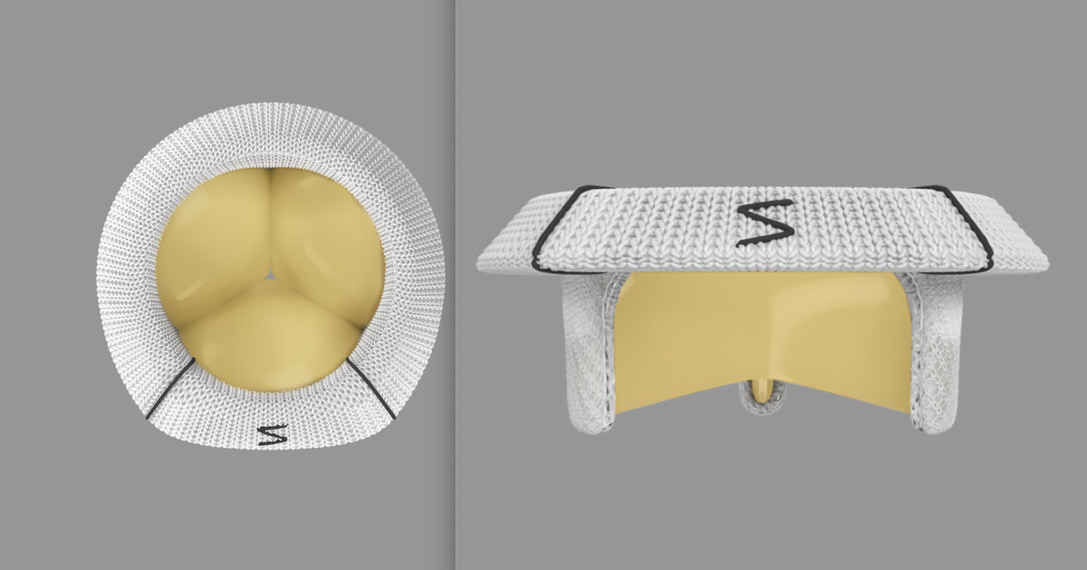 FDA clears first dedicated tricuspid surgical valve