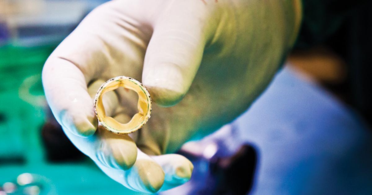 The Lowdown on TAVR: As Risk Drops, Expectations Rise