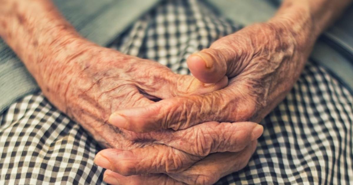 Cachexia common after stroke, linked to lower functional capacity