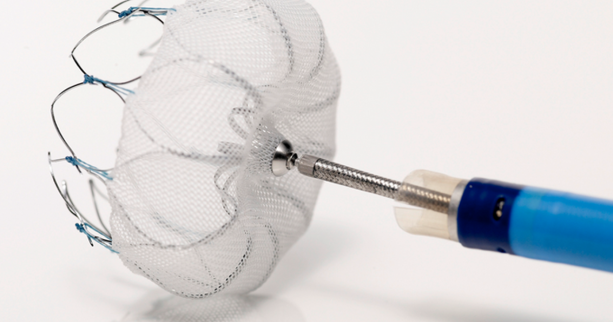 ‘A double-edged sword’: Is the Watchman device more trouble than it’s ...