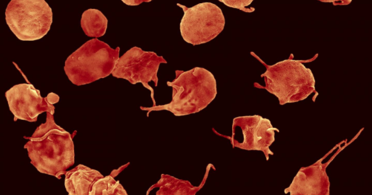 Penn researchers reveal 1st microscopic video of blood clot contraction