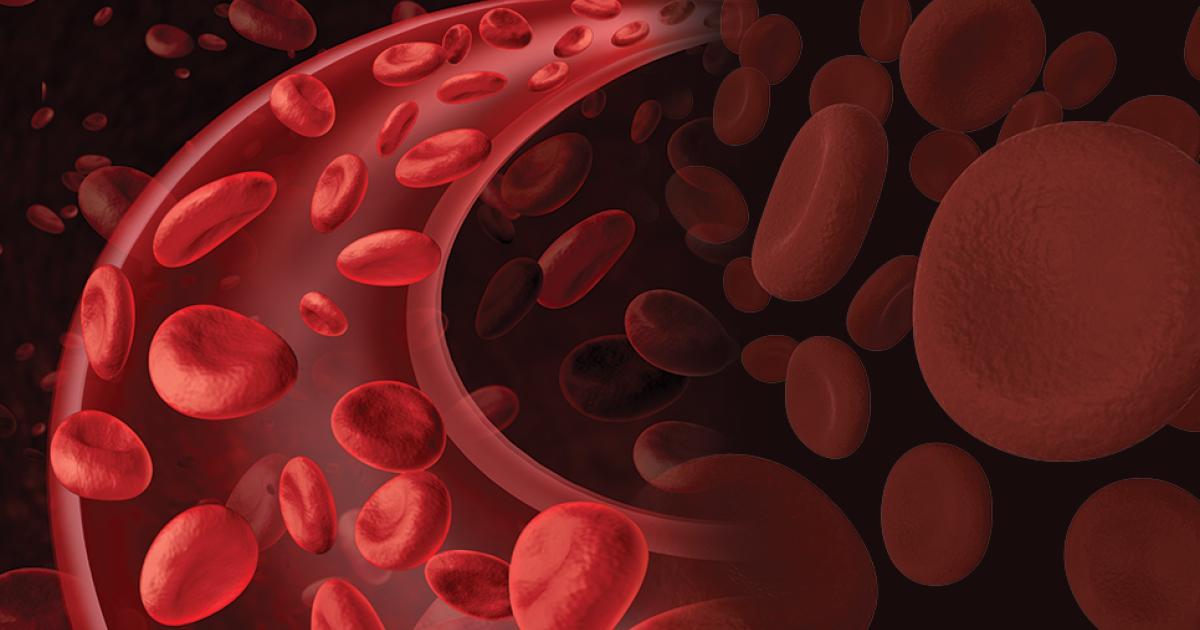 Out on a Limb: Tackling the PAD Knowledge Gap to Save Legs & Lives