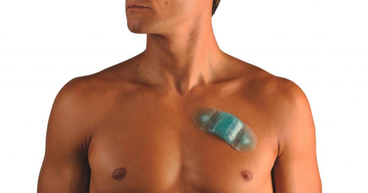Patch challenges Holter monitor for detecting arrhythmias