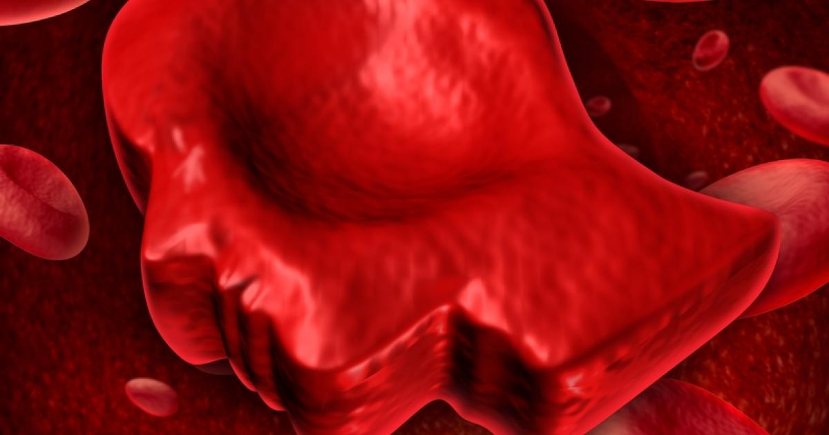 Solitaire stent retriever reduces disability after stroke